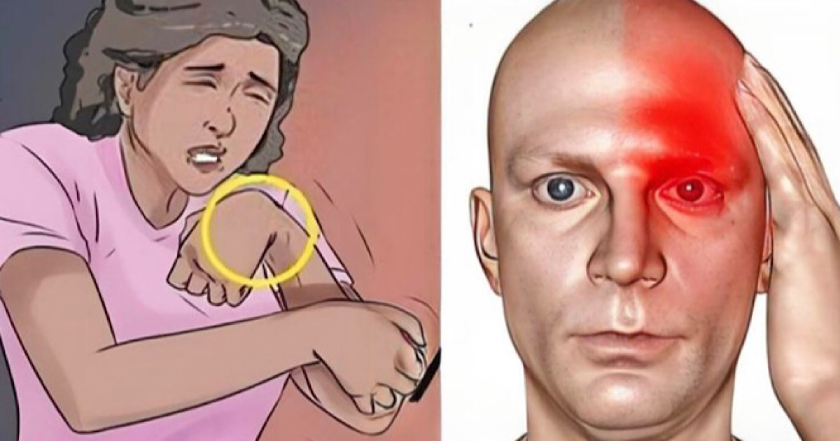 » AVC – 7 sinais que um derrame está a caminho e como prevenir